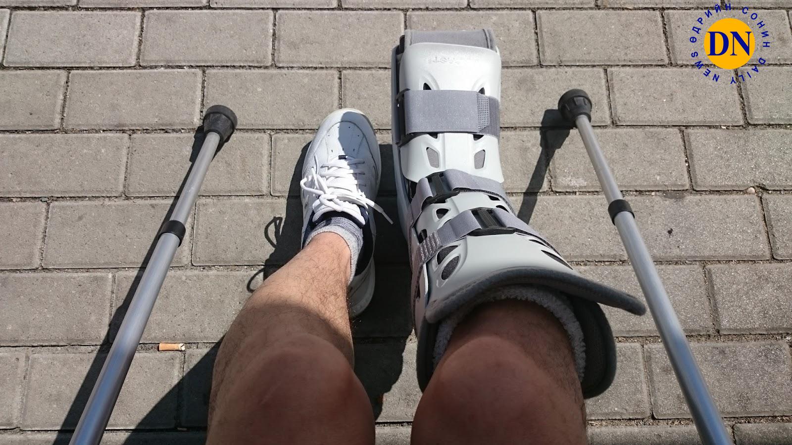 Цахилгаан скүүтрээс үүдэлтэй бэртэж гэмтсэн 100 гаруй хүн ГССҮТ д ханджээ Dnn Mn